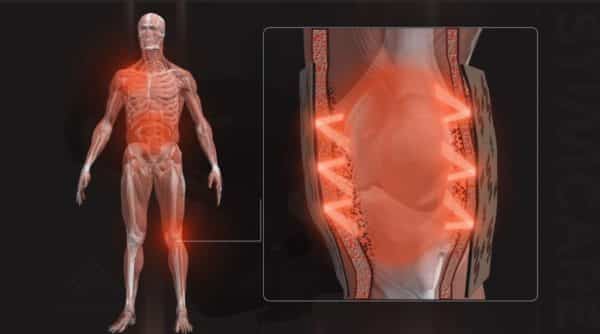 Comprendre et soulager l’inflammation - STIMCARE
